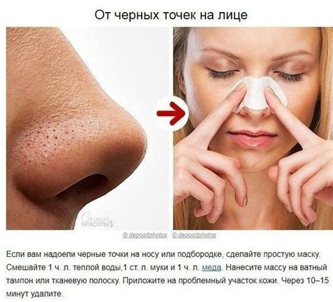 Полезные советы Лицо Лечение прыщей Чистое лицо