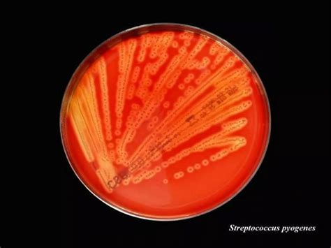 Streptococcus And Enterococcus By Dr Rakesh Prasad Sah Pptx
