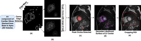Figure B15 Gaussian Kernel Based Circular Hough Transform Approach Download Scientific