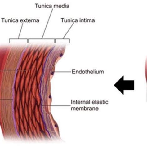 Schematic Representation Of The Elastin Synthesis Download Scientific Diagram