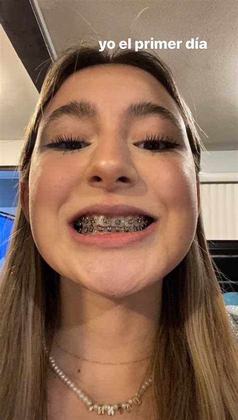 Pin De Patricia Bravo Jimenez En Visión Board 2023 Frenillos Dentales