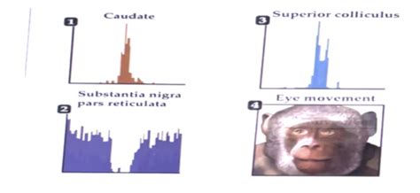 Neuro Study Exam Part 3 Flashcards Quizlet