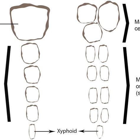 In A An Infants Sternum Is Shown With Six Ossification Centers Download Scientific Diagram