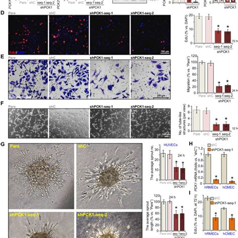 Pck1 Shrna Inhibits Proliferation Migration Tube Formation And