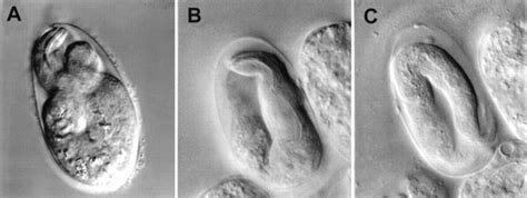 Differential Interference Contrast Micrographs Of Emb 9 Mutant Embryos Download Scientific