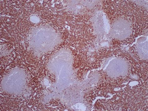 Cd16 Antibody Recombinant Ivd Antibody For Ihc Zeta Corporation