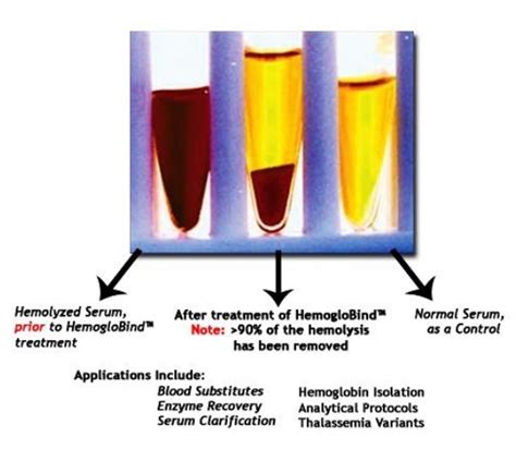 Nugel Hemoglobind™ Hemoglobin Capture Reagent From Blood And