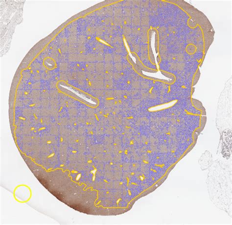 Checkersboard When Positive Cell Detection Usage And Issues Image Sc Forum