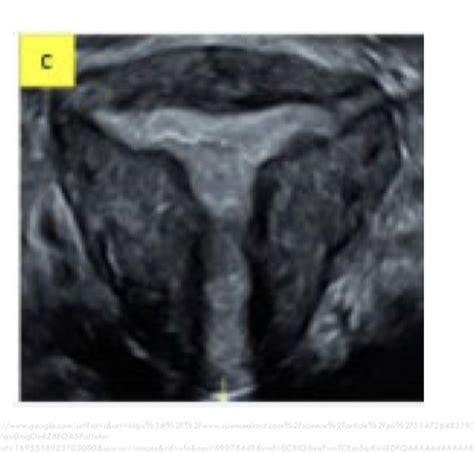 Congenital Abnormalities Flashcards Quizlet