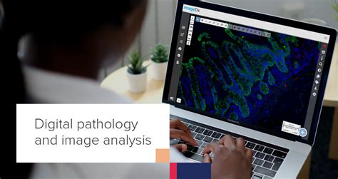 Cellcarta On Linkedin Digital Pathology And Image Analysis Cellcarta
