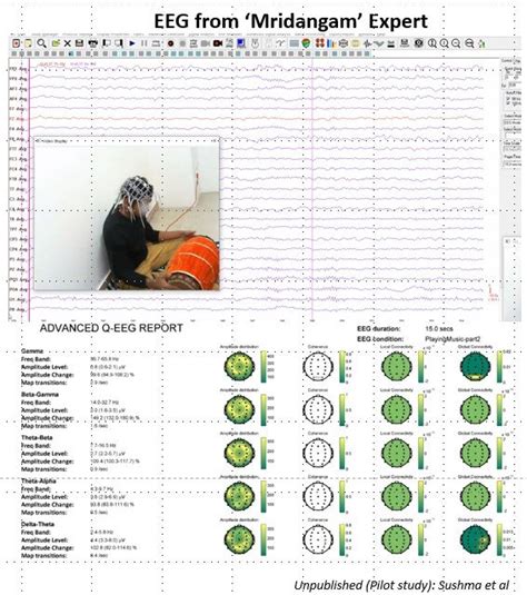 PDF Single Sample EEG While Performing Music