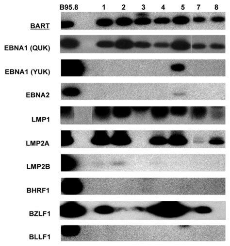 Comprehensive Profiling Of Ebv Gene Expression And Promoter Methylation