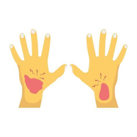 Trendy Hand Bleeding 13698402 Vector Art At Vecteezy