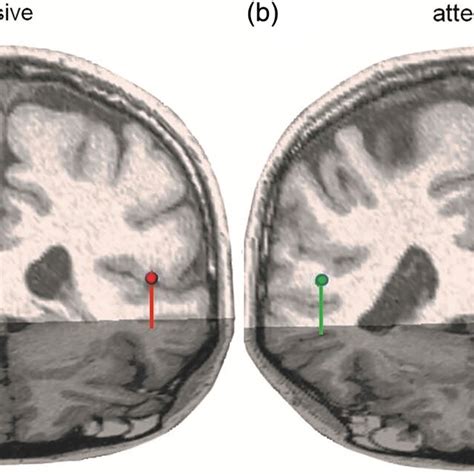 Estimated Cortical Dynamics Of The Gating Generators In The Primary