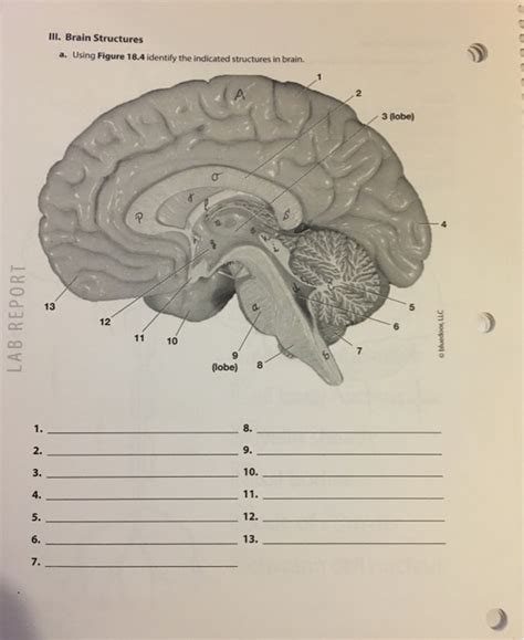 Solved III Brain Structures Using Figure Identify The Chegg