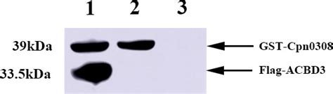 The Chlamydia Pneumoniae Inclusion Membrane Protein Cpn0308 Interacts