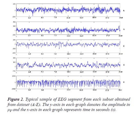 A Novel Unsupervised Automated Epileptic Biomedical Research