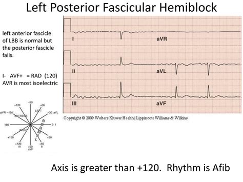 Ppt Axis Chapter 8 Powerpoint Presentation Free Download Id 6714816