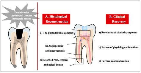 Ijms Free Full Text Functional Dental Pulp Regeneration Basic