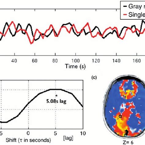 Using Temporal Cross Correlation To Measure Lag In Resting State Fmri Download Scientific