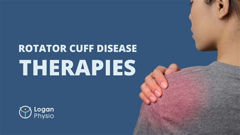 Injection Therapies For Rotator Cuff Disease What Works Best Logan