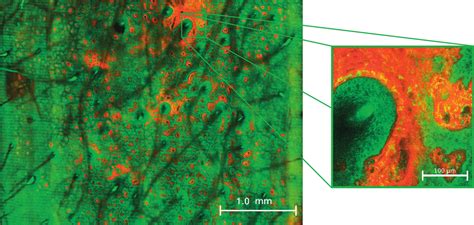 6 Large Scale Optical Sectioning 10 Mm 2 Can Be Obtained By Download Scientific Diagram