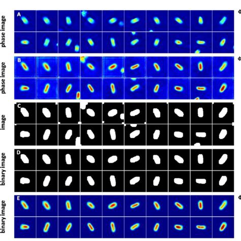 segmentation and postprocessing pipeline for individual bacteria