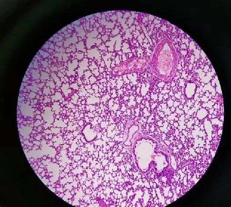 🔬肺部组织切片he染色观察指南