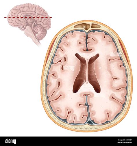Corpus Callosum Diagram