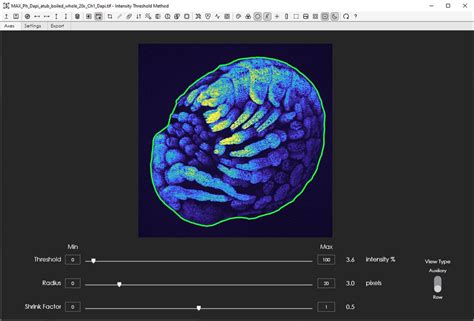 영상 처리 및 Ai 기반 광시트 현미경 툴 Matlab And Simulink