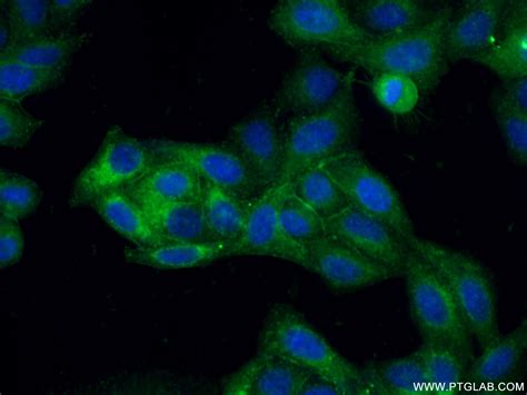 Bcl Xl Antibody 26967 1 Ap Proteintech