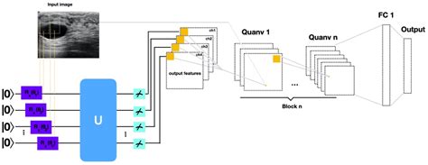Entropy Free Full Text Breast Cancer Detection With Quanvolutional