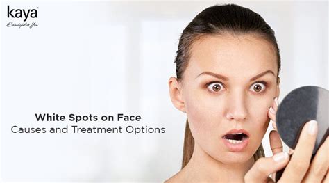 White Spots On The Skin Possible Causes And Treatments Blog