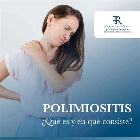 La Polimiositis Es Una Dr Guillermo Félix Rodríguez
