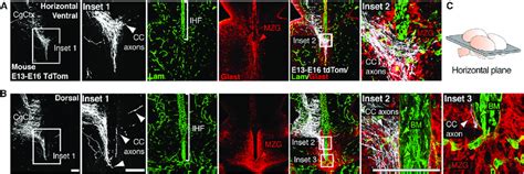 Pioneer Callosal Axons Do Not Cross Through The Ihf But Rather Use The Download Scientific