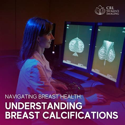 Navigating Breast Health Understanding Breast Calcifications Consulting Radiologists