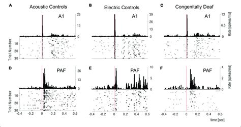 Peristimulus Histogram And Spike Raster Plot Examples Examples Of Download Scientific