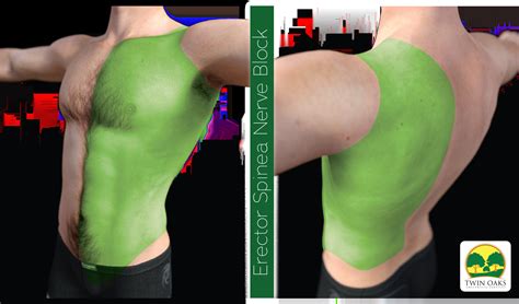 Procedure Notes CRNA Conferences Twin Oaks Anesthesia