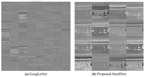 Deep Learning Based Arrhythmia Detection Using Ecg Signals A