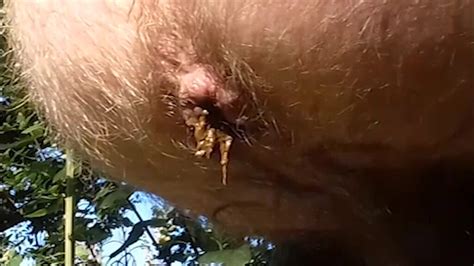 Pov Poo Pee Squat Outdoor At Hiking Time