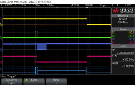 Solved Stm32f415 Dma Spi Transfer After Stop Mode Page 2 Stmicroelectronics Community