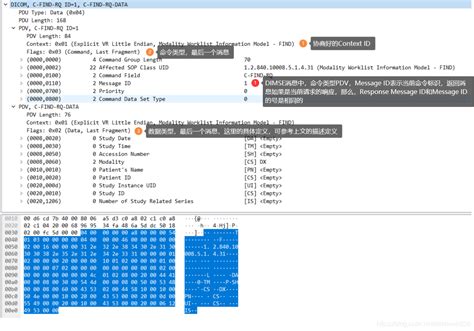 dicom通讯（acse ＞dimse ＞worklist） worklist传输 csdn博客