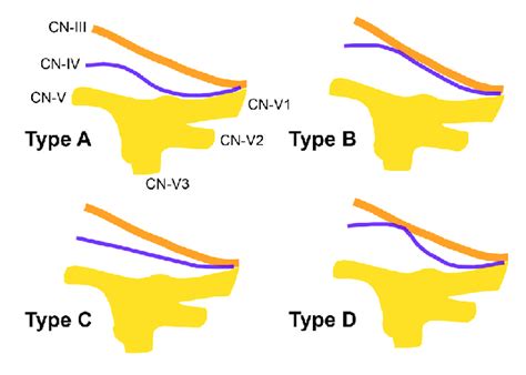 Schematic Illustration Depicting Morphological Types Of Supratrochlear