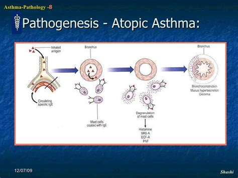 Asthma Pathophysiology N