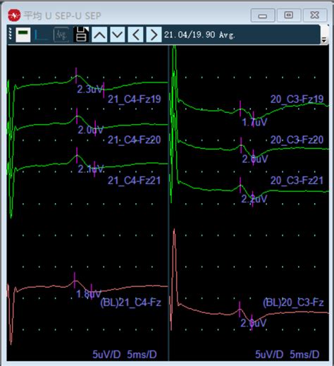 Product Application Ncc Medical Co Ltd