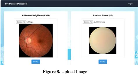 Figure 8 From Analysis Of Eye Disease Classification By Comparison Of The Random Forest Method