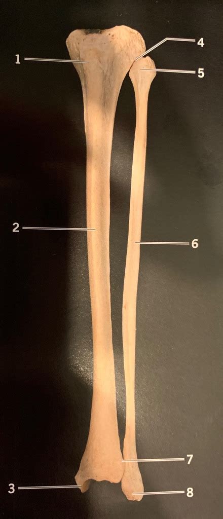 Left Articulated Tibia And Fibula Anterior View Diagram Quizlet
