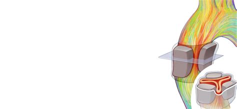 Recreating Cardiovascular Disease Using Soft Robotics Research