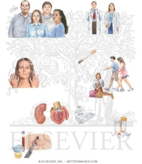 Managing Your Scleroderma