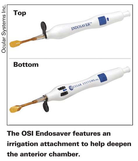 The Secret To Gentler Dsaek Grafts